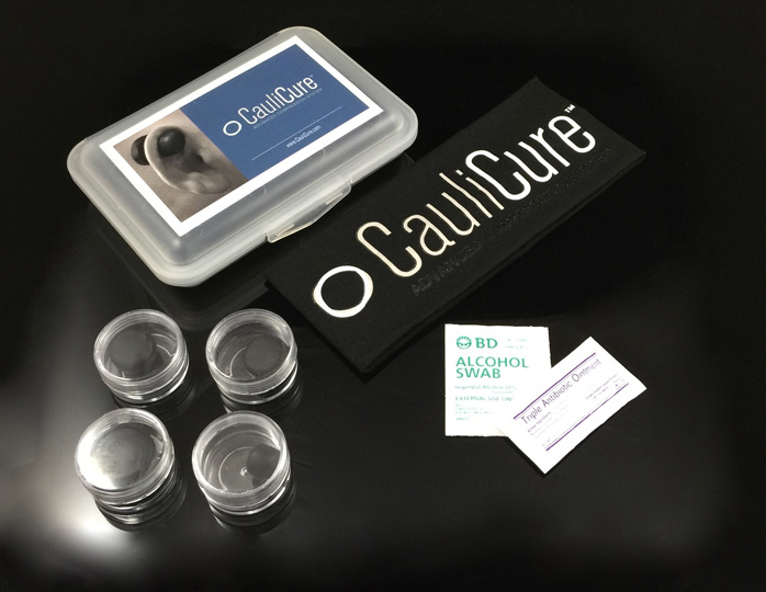 CauliCure Advanced Compression System for Cauliflower Ears ...