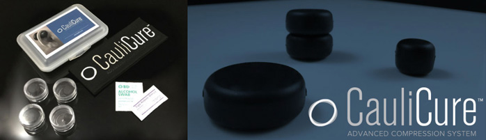 CauliCure Advanced Compression System for Cauliflower Ears ...